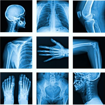 CCMH Radiology | Campbell County Health
