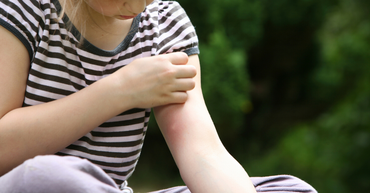 Common Summer Injuries & Illnesses